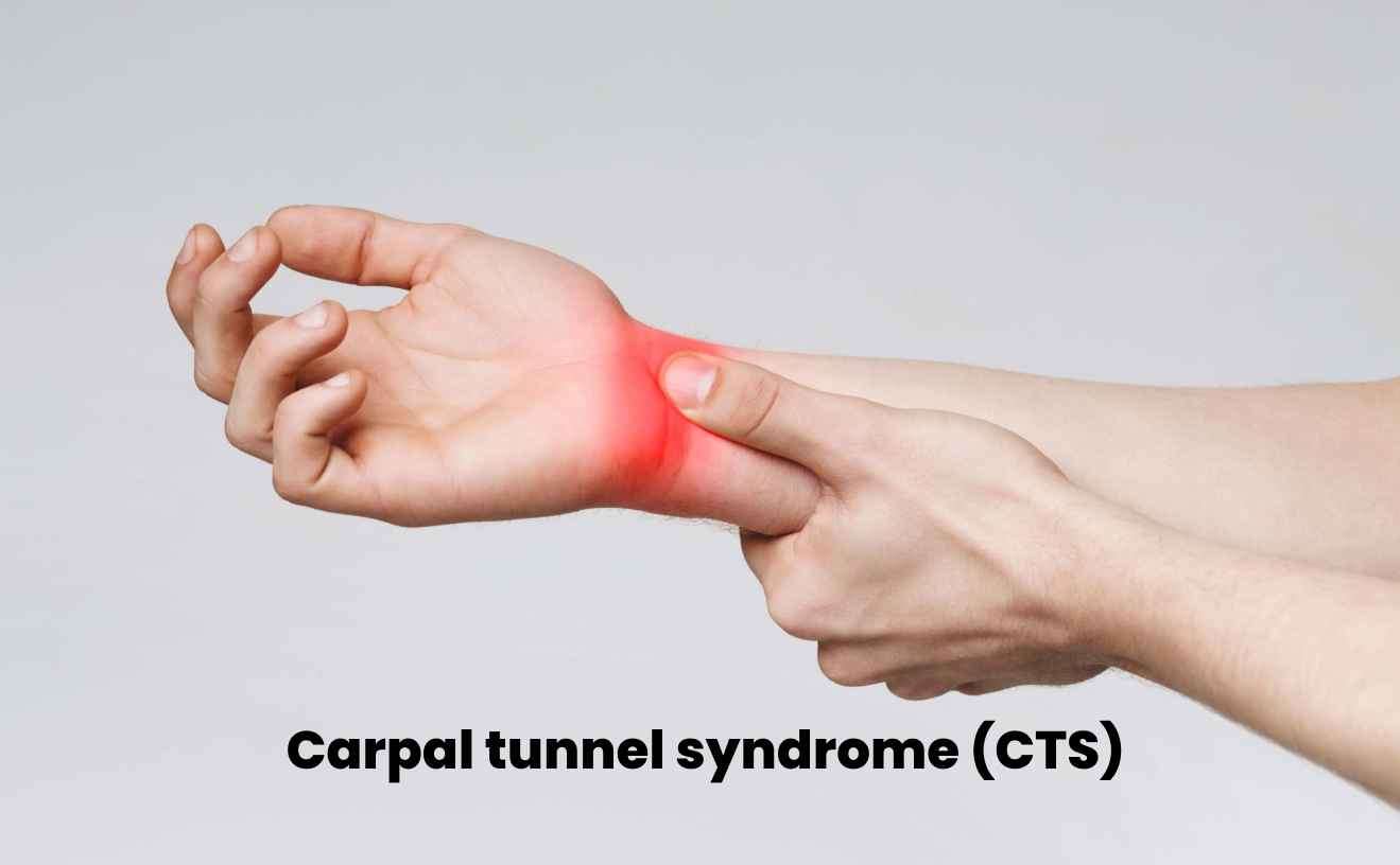 Relieve Carpal Tunnel: Treatments, Surgery, and Pain Management ...